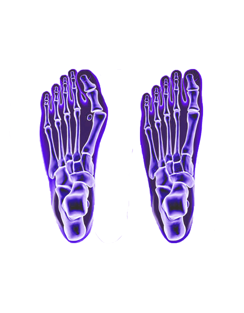 Aesthetic And Functional Foot Surgery - Nisantasi FootPlus Clinic ...