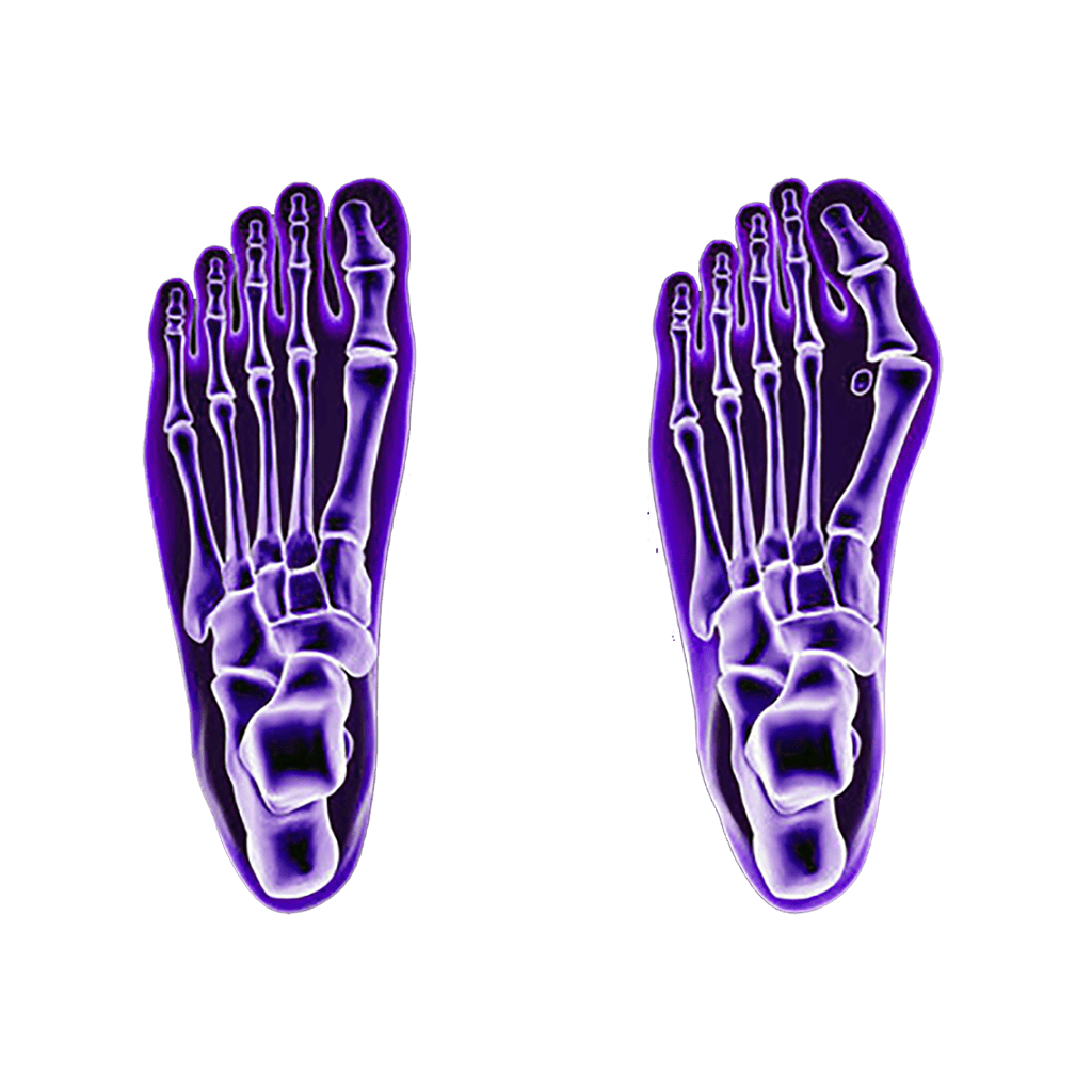 Foot Surgery And Deformity Reconstruction Nisantasi Footplus Clinic