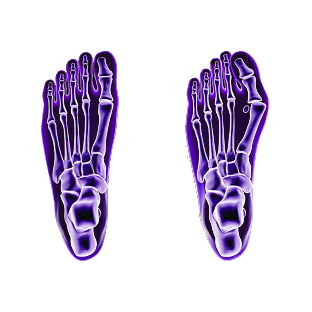 Foot Surgery And Deformity Reconstruction - Nisantasi FootPlus Clinic ...