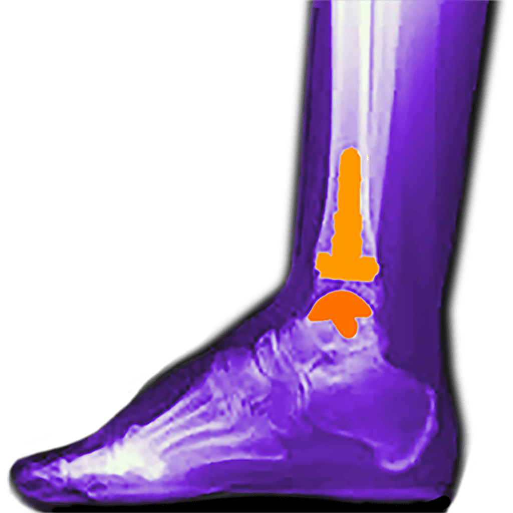 Effective Treatments & Practices for Optimal Foot and Ankle Health