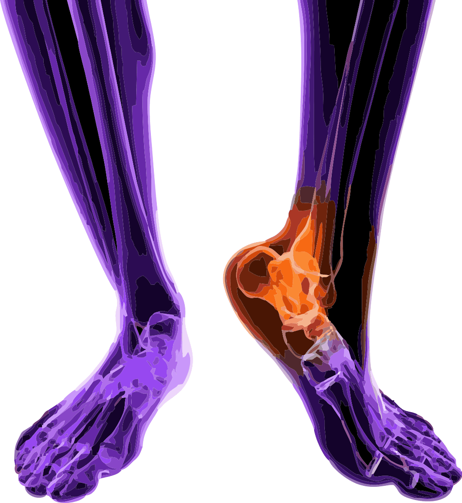 Orthopedic Sports Injuries - Nisantasi FootPlus Clinic - Treatments ... Orthopedic Sports Injuries - Nisantasi FootPlus Clinic - Treatments ...