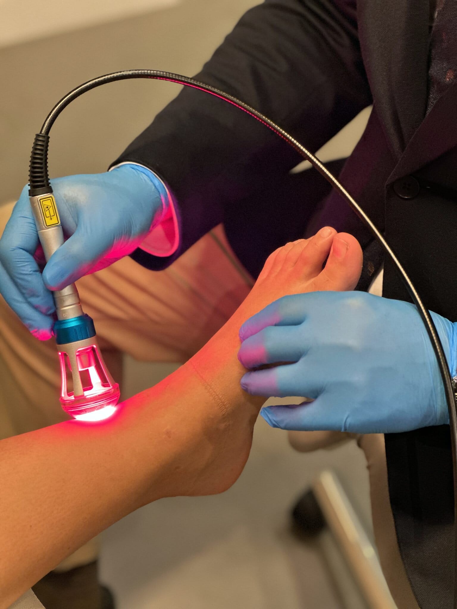 Révolutionnez la santé de vos pieds avec la thérapie au laser à la ...